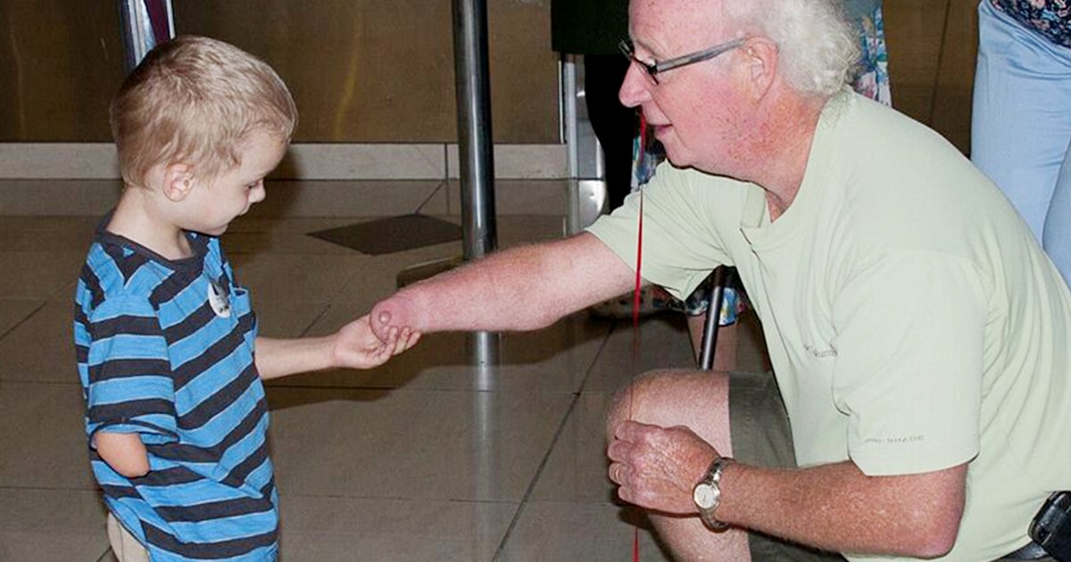 Adopted boy born without a hand finds family who truly understands