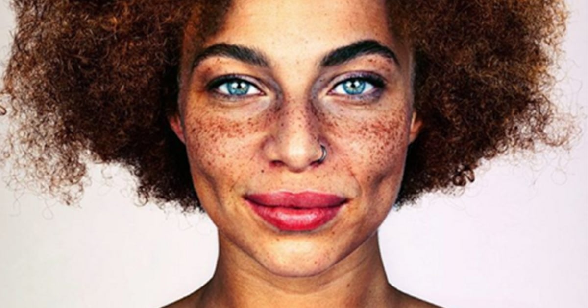#Freckles: Photographer shines spotlight on the beauty of spots #Freckles: Photographer shines spotlight on the beauty of spots