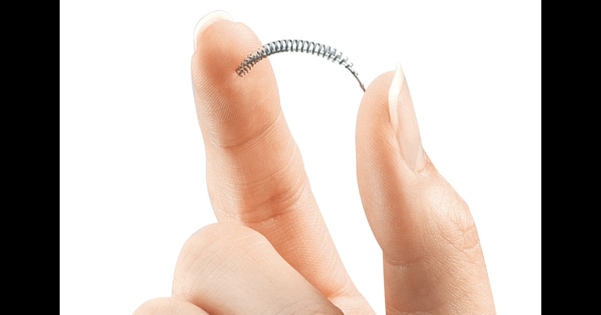 New, stronger warning on Essure birth control implant