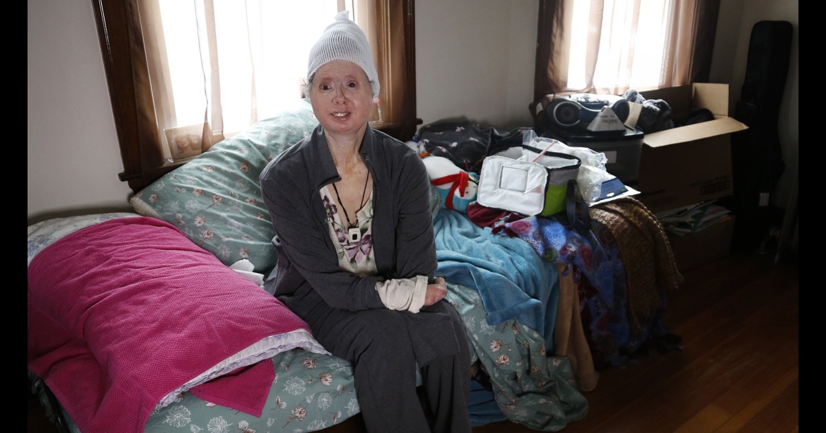 Chimp attack survivor Charla Nash hopes to give back by helping wounded ...