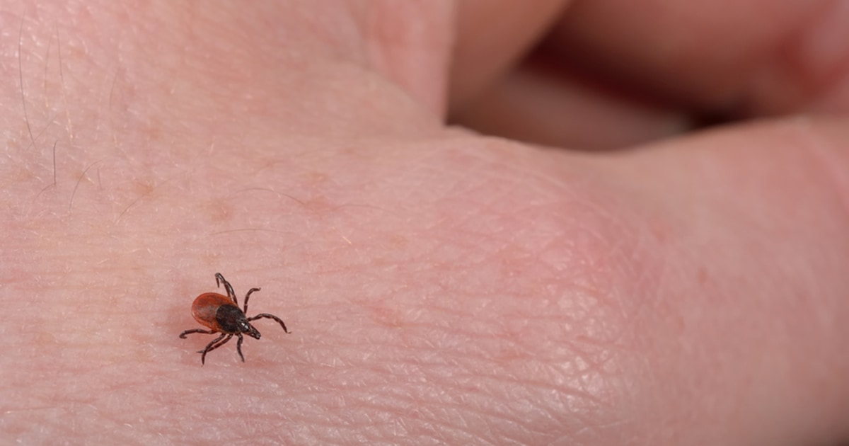 What is tick paralysis? The rare disease caused by ticks