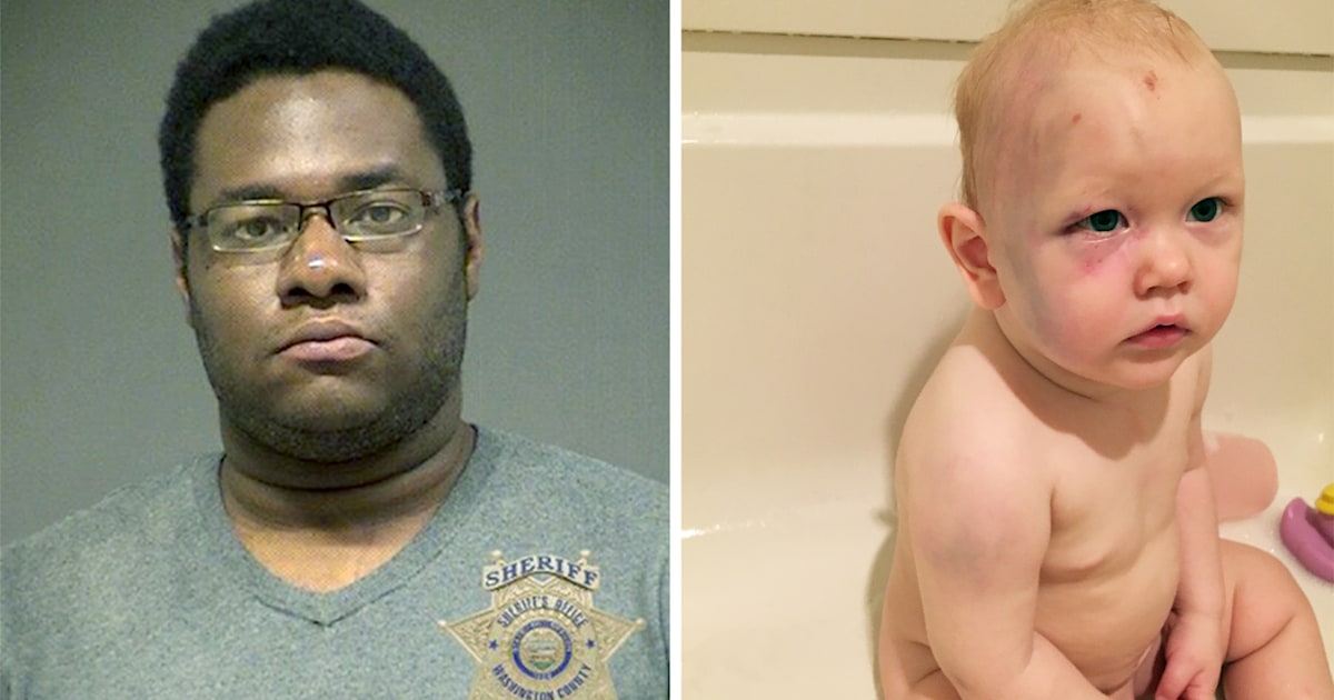 Public outrage results in arrest in case of battered baby