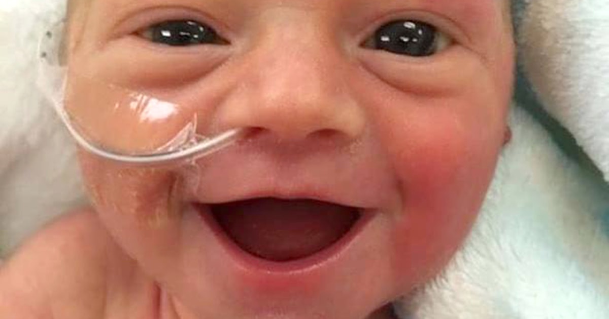 Family of smiling preemie shares daughter's birth story