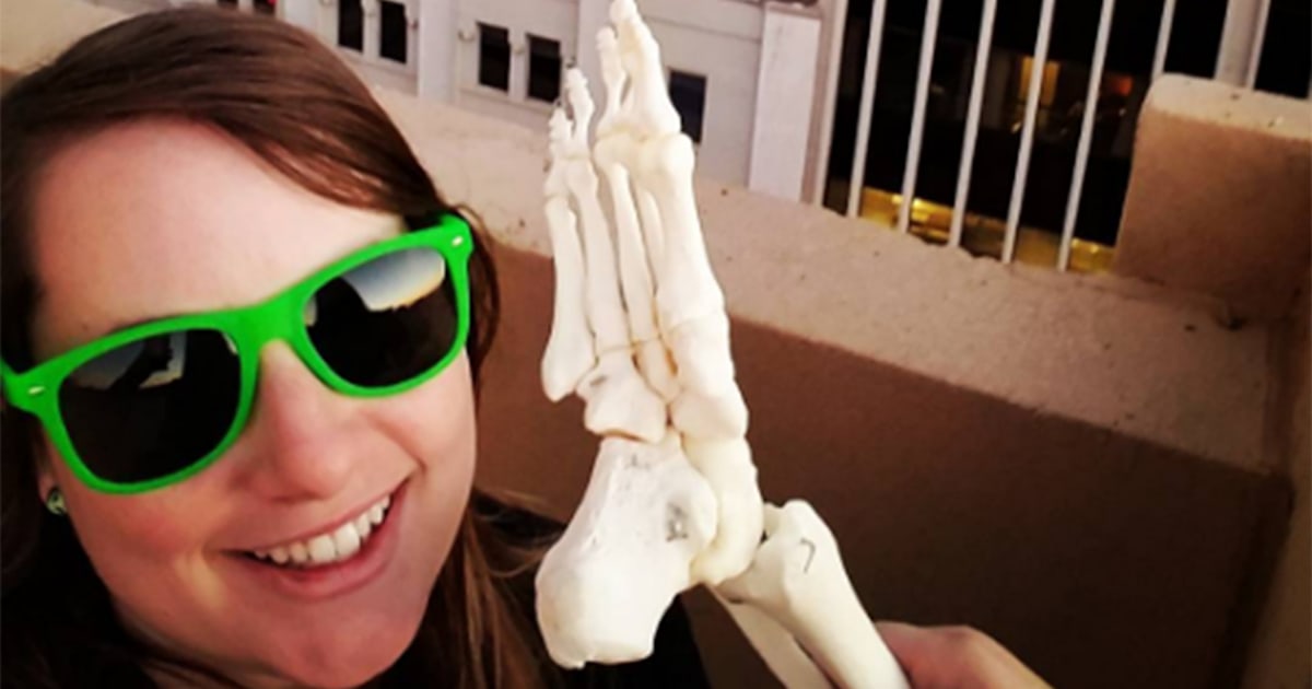 Cancer survivor turns her amputated foot into Instagram star