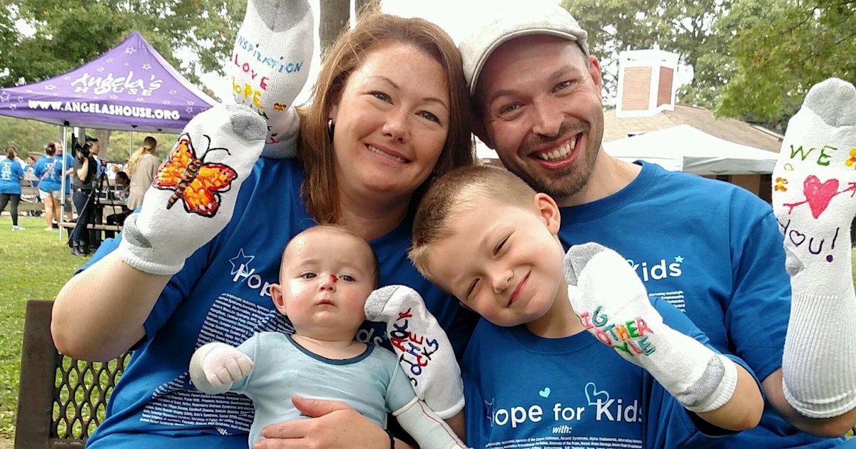 'Rock the socks' to support baby with epidermolysis bullosa