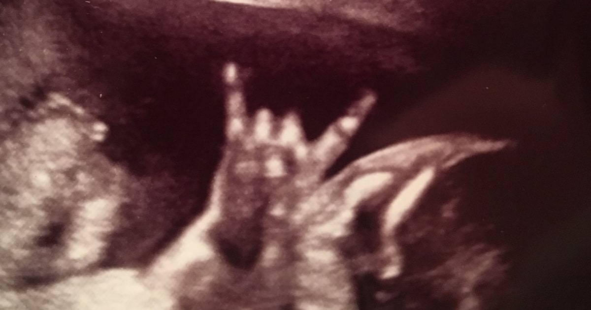 Ready to rock! Baby makes heavy metal ‘horns’ in ultrasound pic