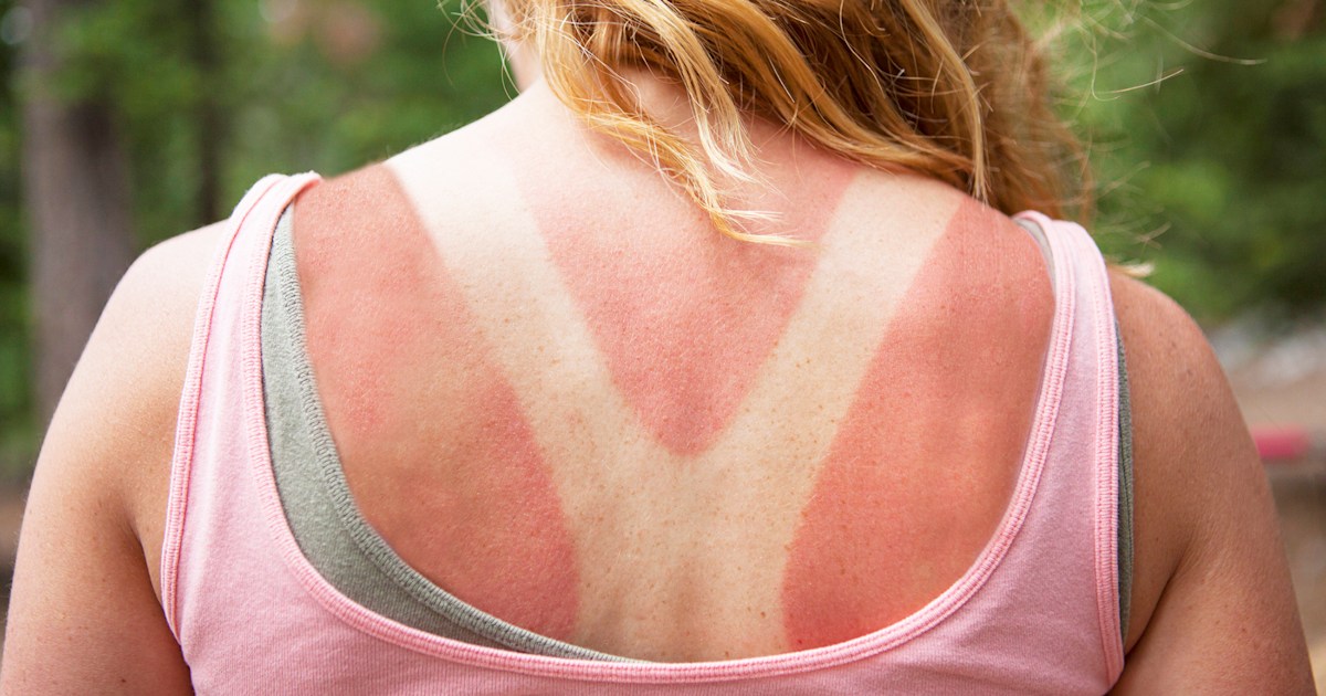 How to prevent swimmer's ear this summer