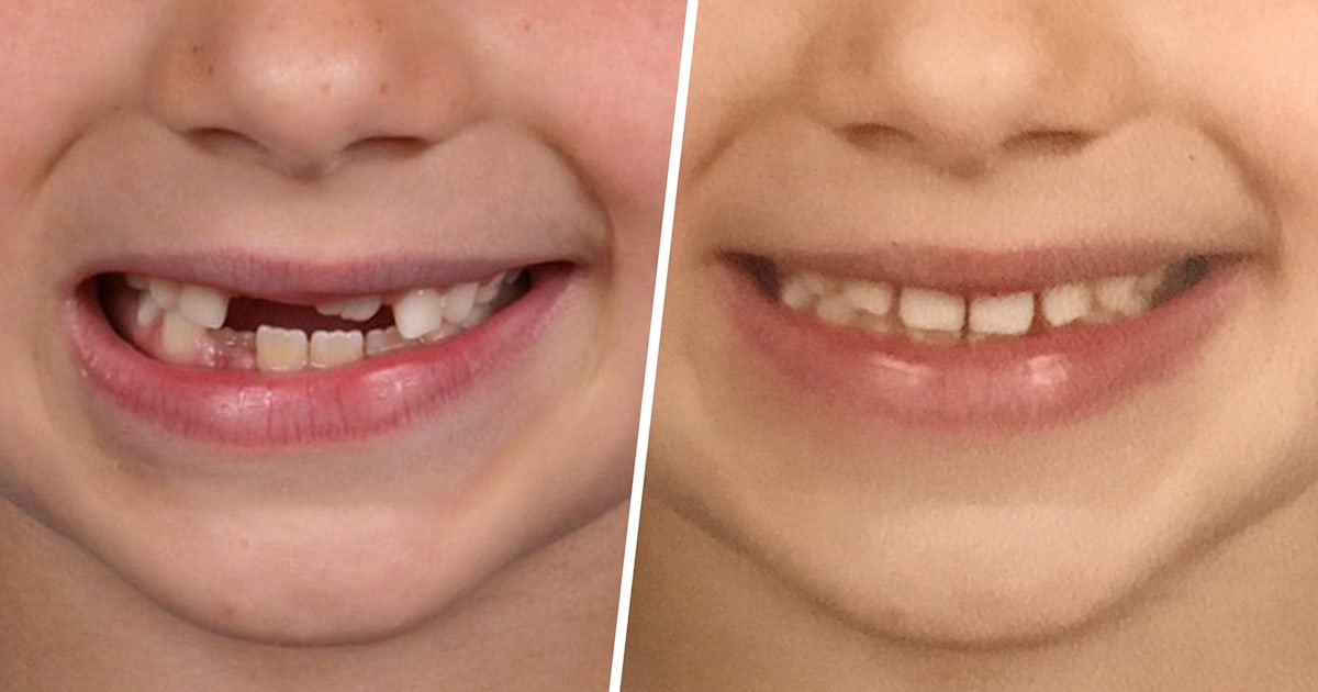 Mom's post about retouched school photo grin goes viral