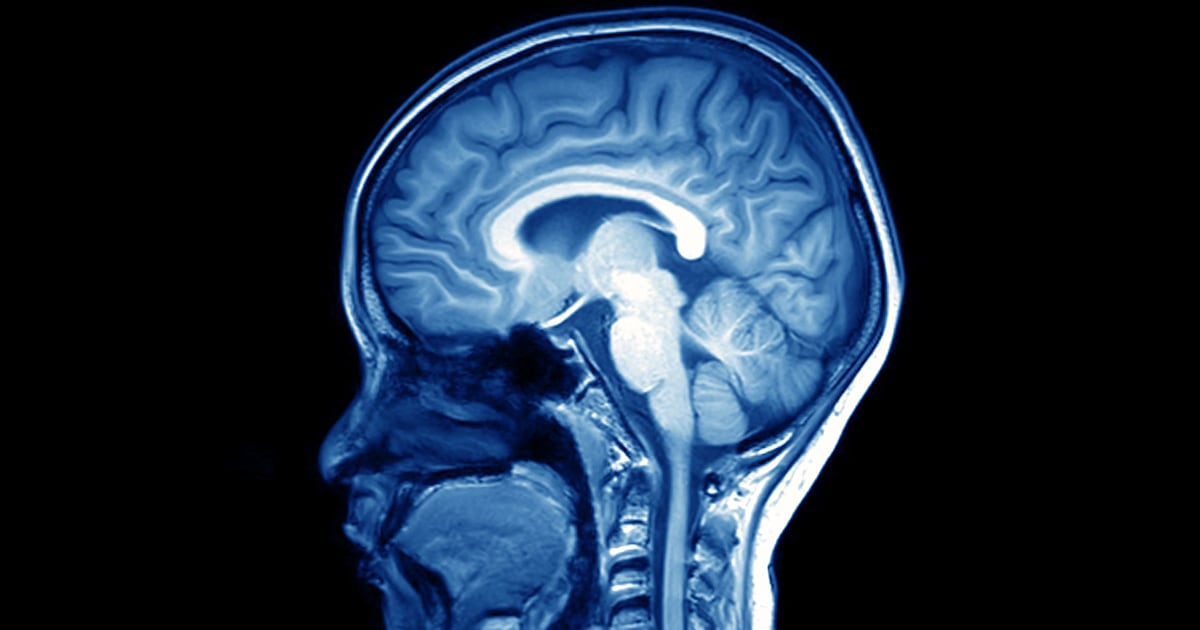 Fluid leaking from brain into ear is linked to obesity