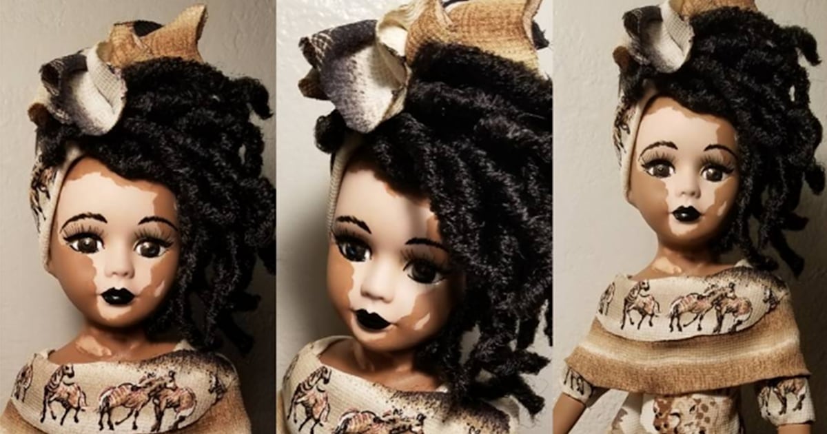 Kay Customz creates dolls with vitiligo, diverse features