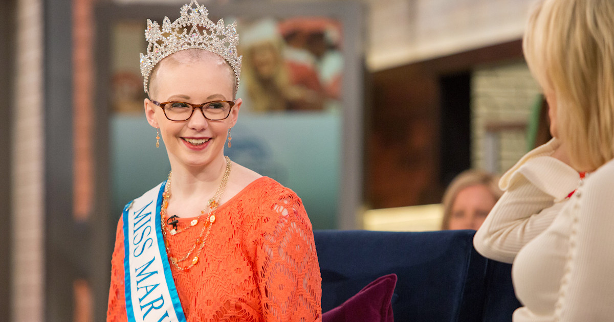 Bald teen with hair-pulling disorder wins beauty pageant - and raises ...
