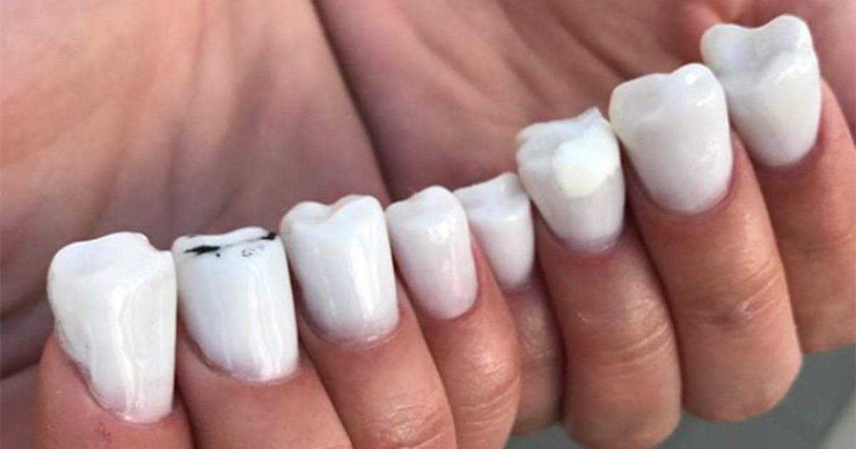 'Molar nails' are the creepy new nail trend taking over Instagram