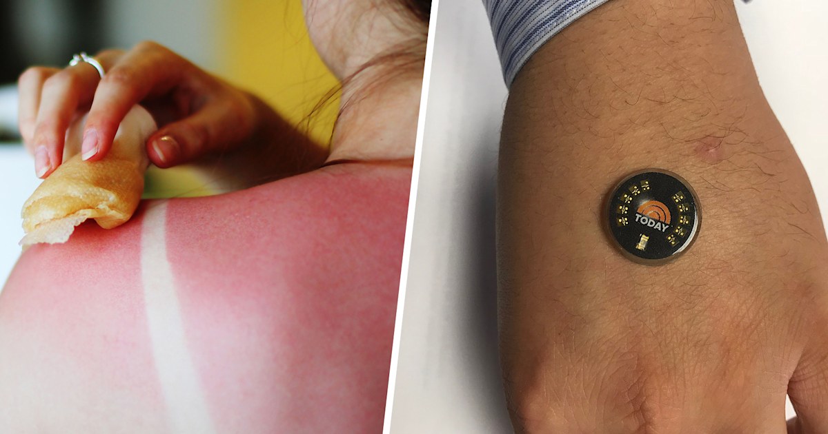 UV Sense: Sun sensor to prevent sunburns & skin cancer