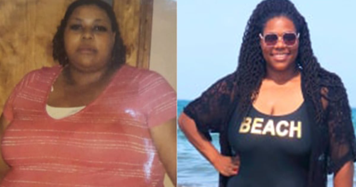 Woman loses 95 pounds with keto diet, intermittent fasting