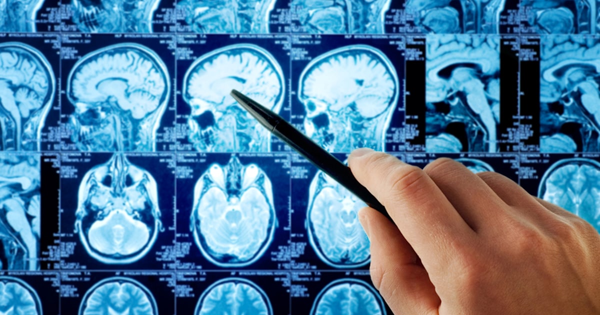 Inside the male brain: Why do men behave the way they do?