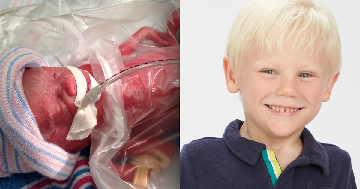 Micro-preemie baby headed back-to-school to kindergarten