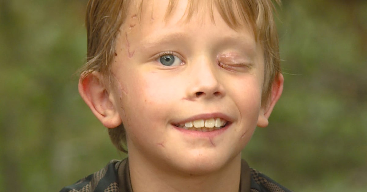 lion attack human face