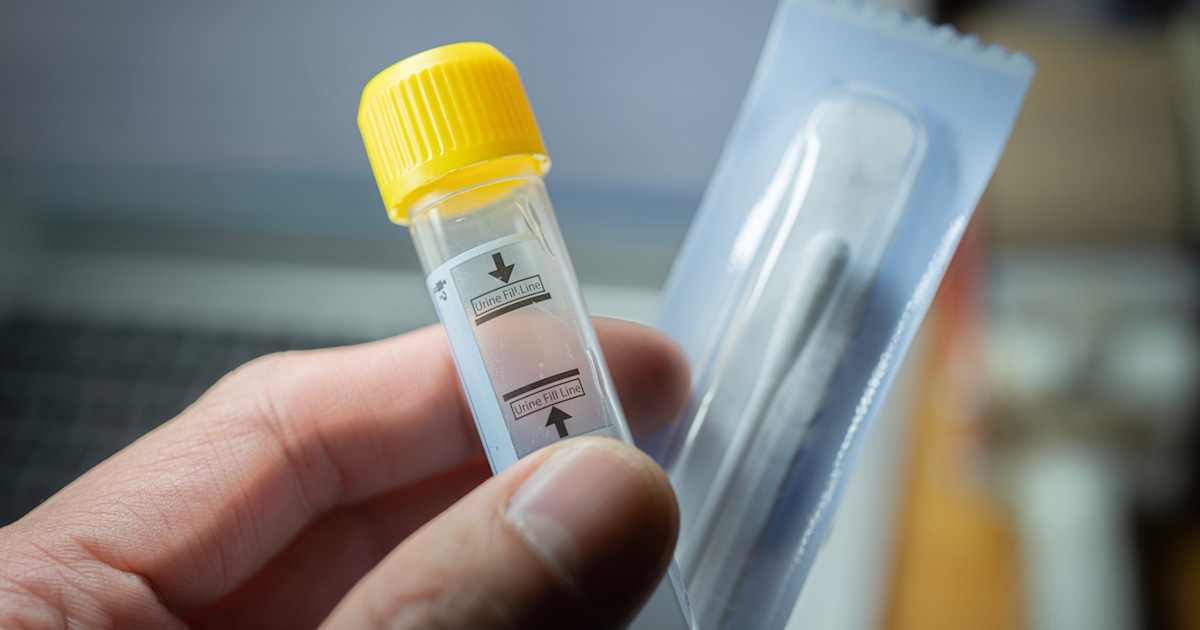 Chlamydia, gonorrhea and syphilis reach record rates in the US