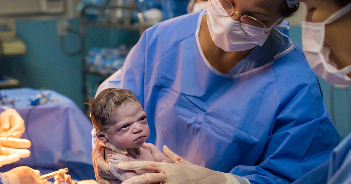 Grumpy baby in Brazil stares down doctor in viral picture
