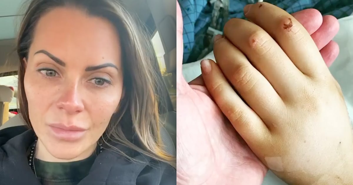 Michelle Money says daughter will 'be OK' after brain trauma