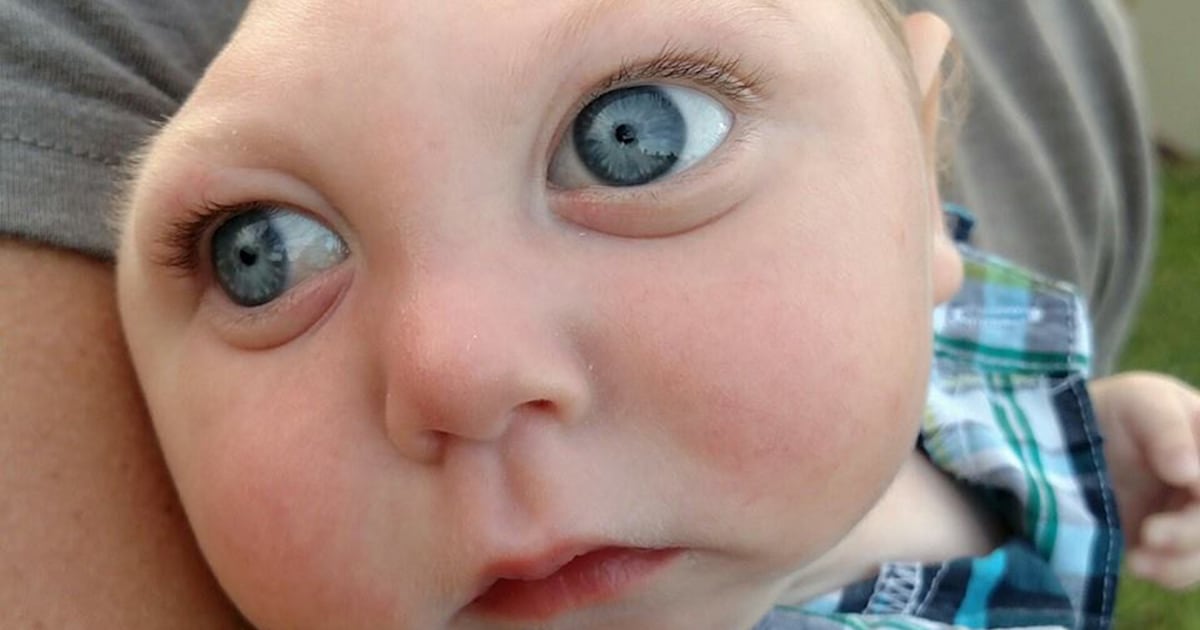 'Jaxon Strong:' Baby missing part of brain thrives despite odds