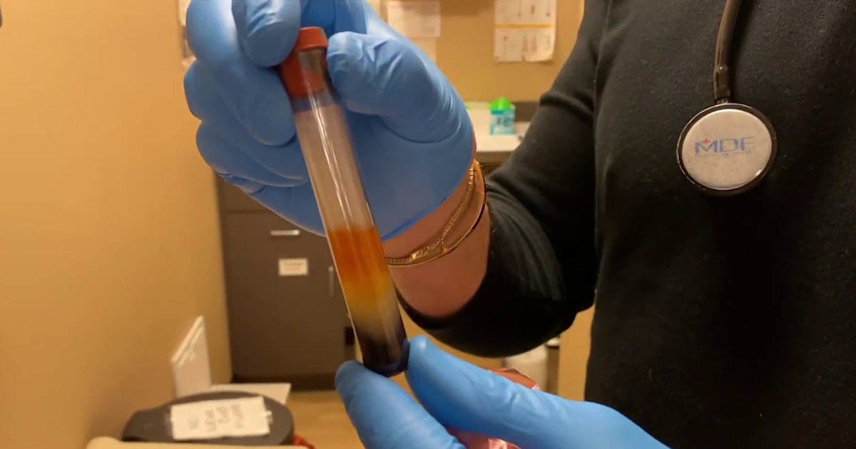 Coronavirus antibody test: What you need to know before getting tested