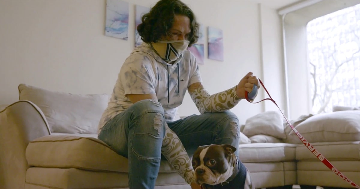 Man undergoes first successful face and hand transplant surgery