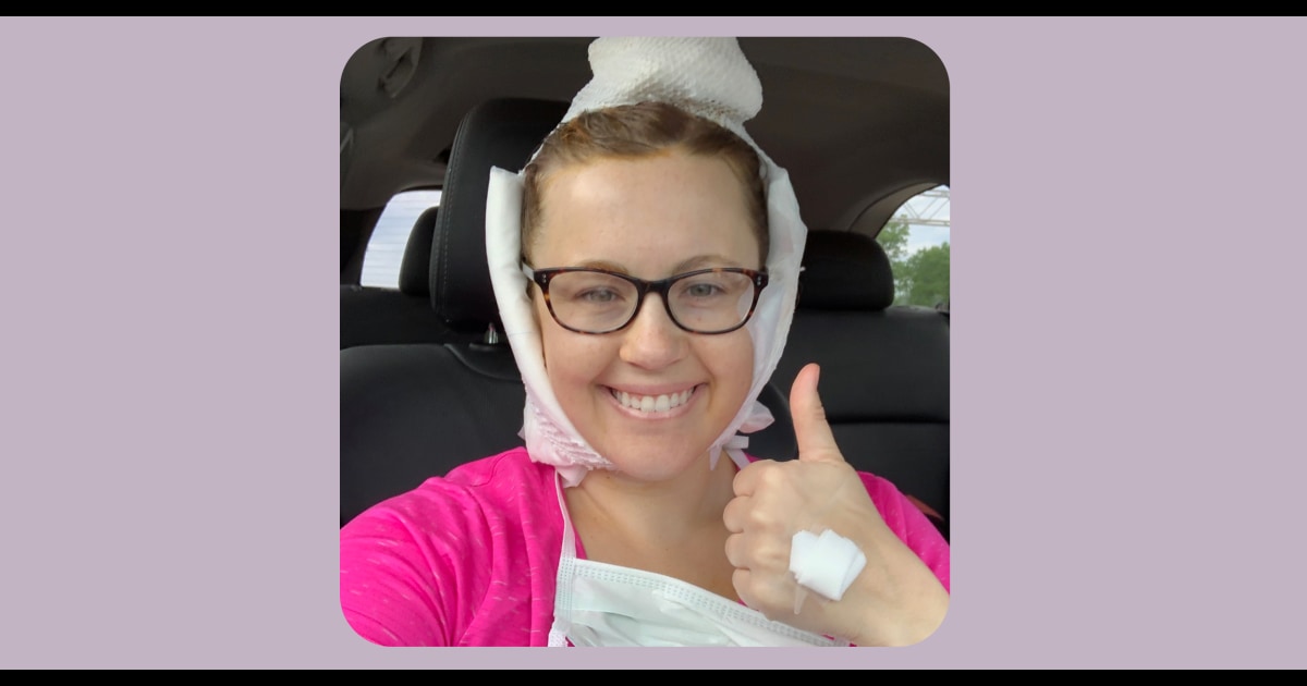 Skin Cancer On Scalp One Womans Story With Scalp Melanoma