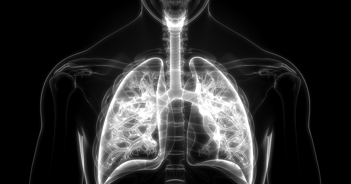 FDA approves Amgen drug for lung cancer with specific mutation