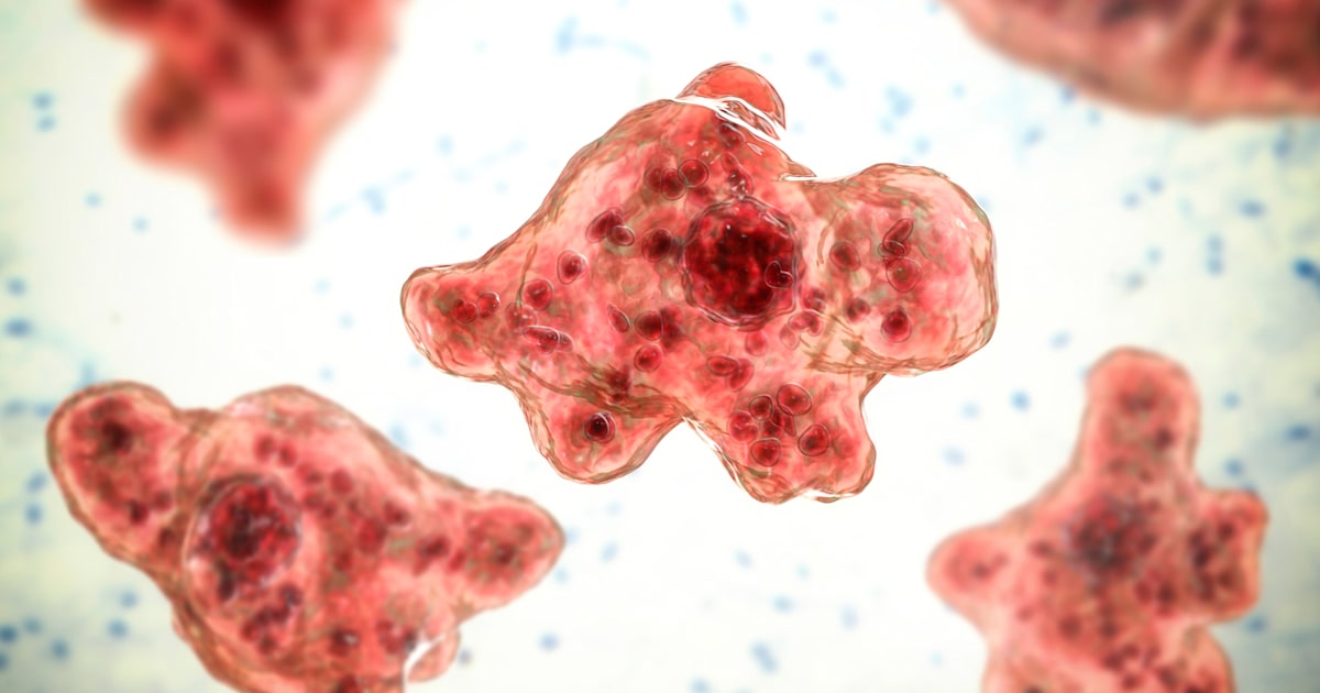 Boy, 7, dies from brain-eating amoeba in California
