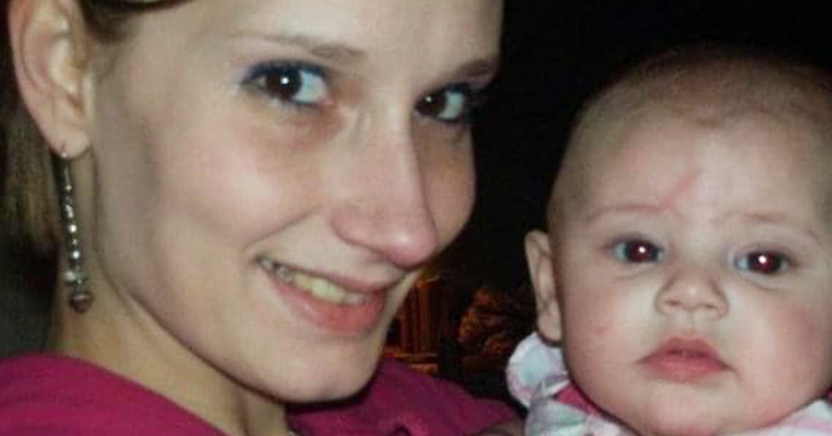 Can you lose teeth during pregnancy? What dentists want people to know