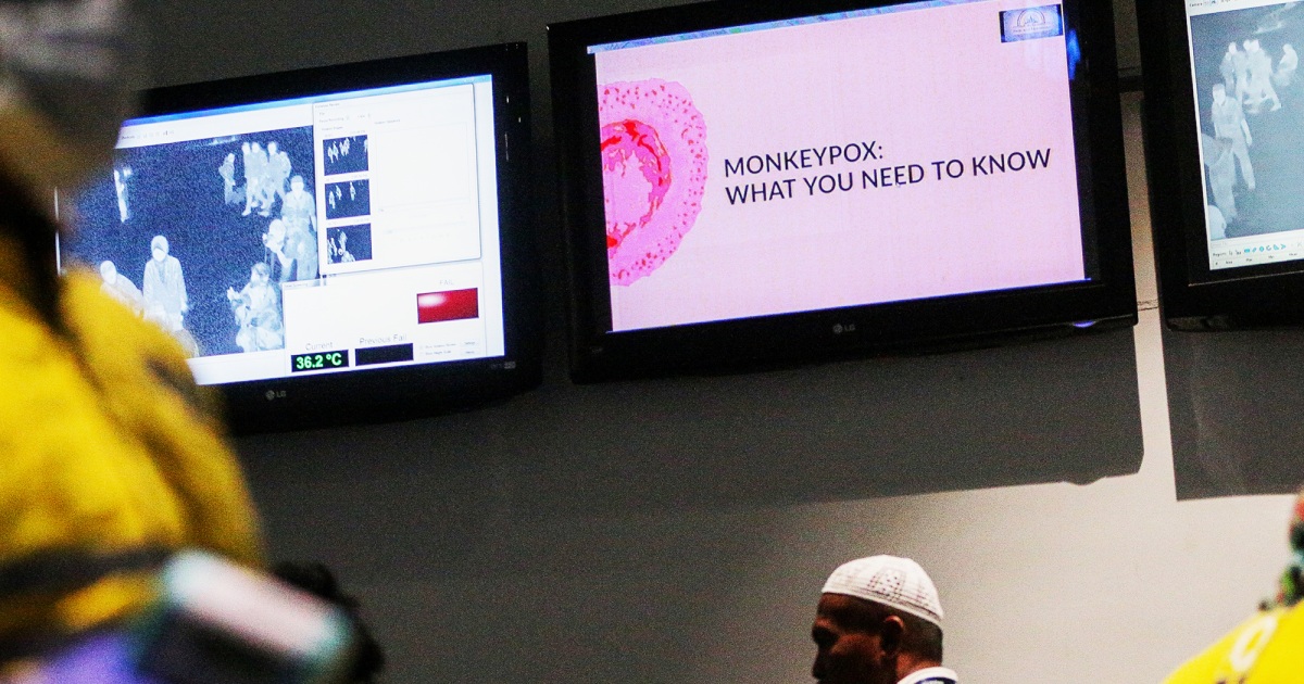 What is monkeypox and how do you catch it?
