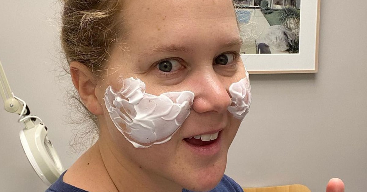 Amy Schumer gets face fillers dissolved