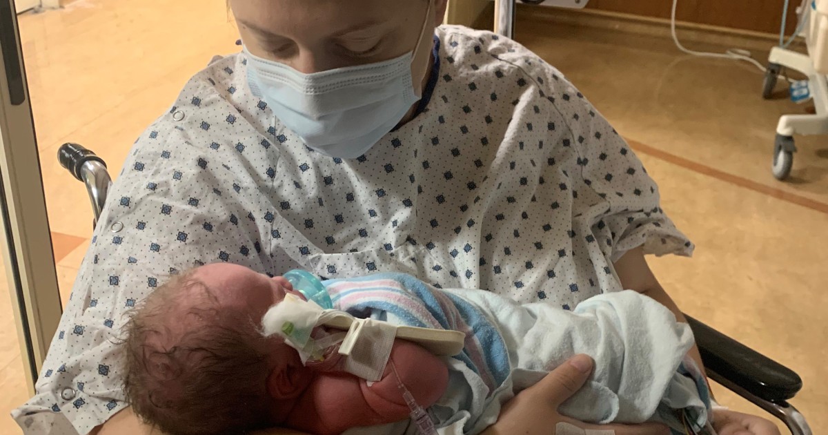 Baby Is Thriving After In-Utero Surgery To Remove Tumor