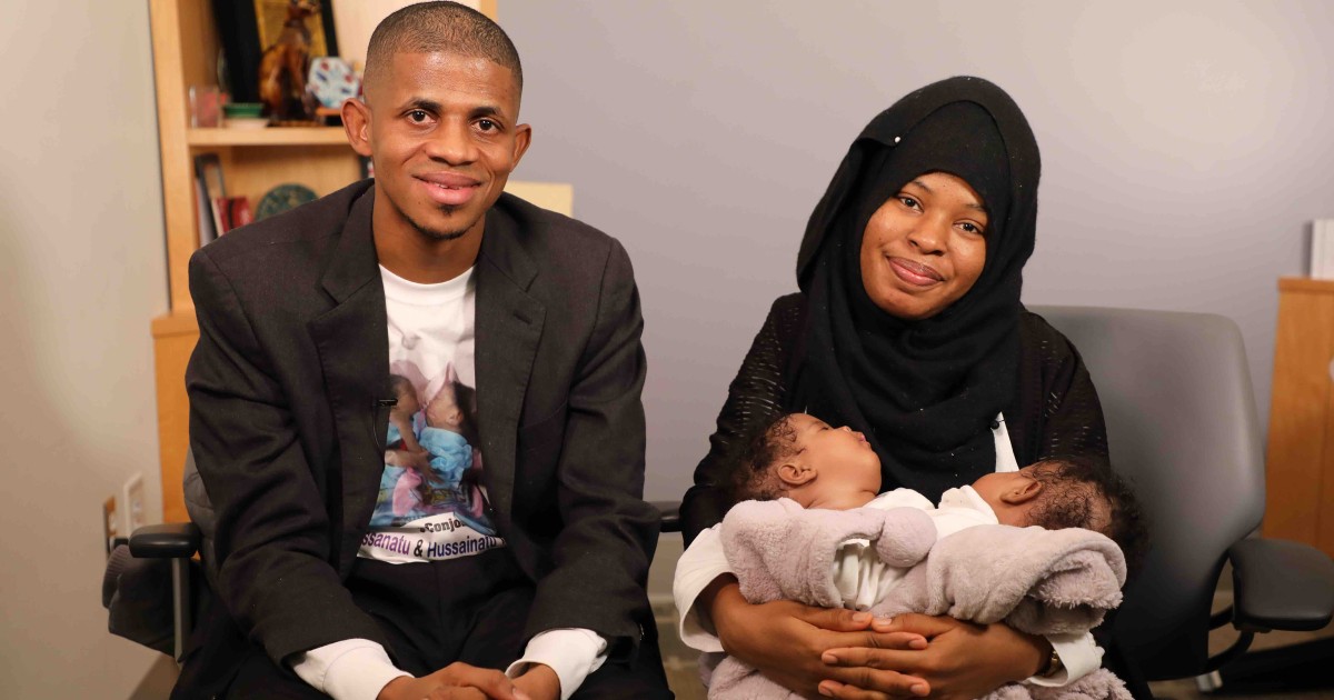 Conjoined Twins Separated 2 Years Ago Are Thriving