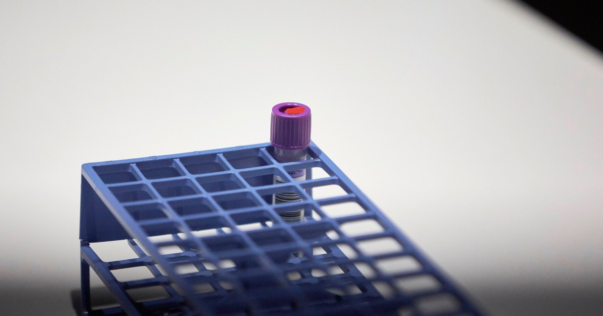 Second US case of omicron variant is found in Minnesota