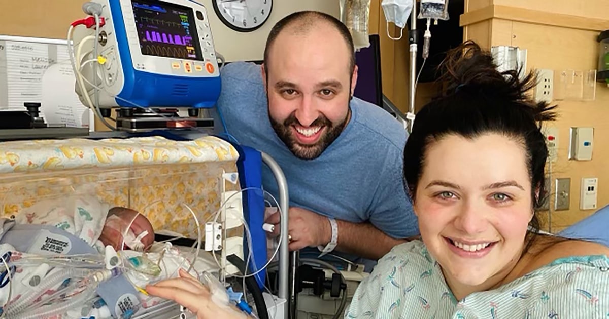 Baby Receives Rare, Lifesaving Surgery Mid-Birth To Help Him Breathe