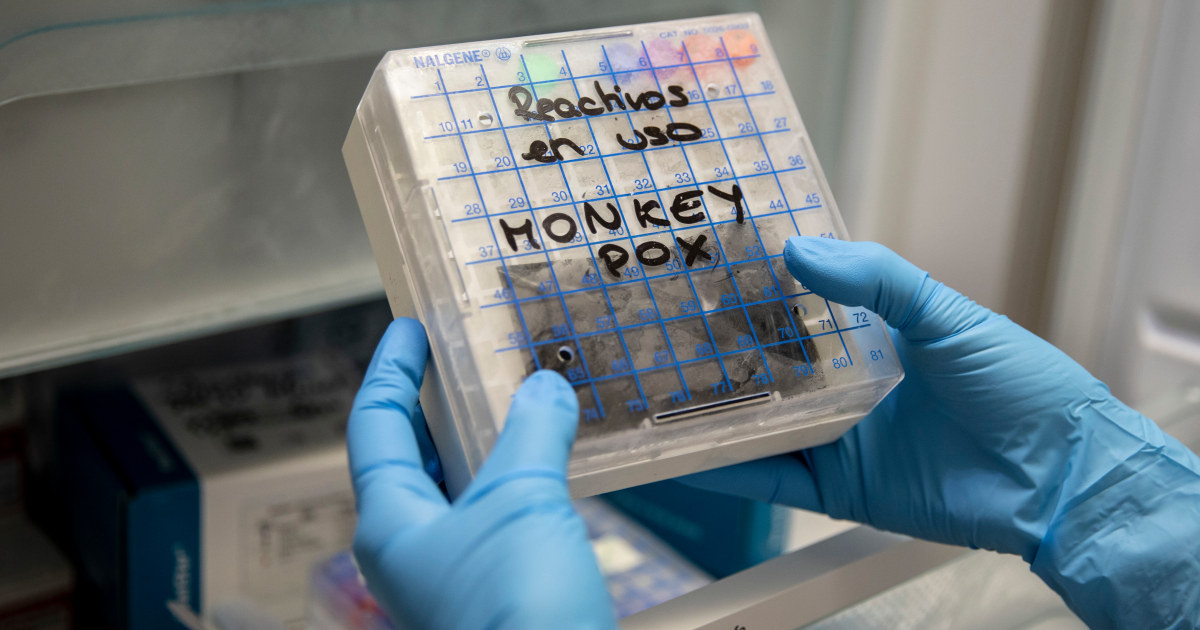 Monkeypox Warning Issued by CDC: What It Means