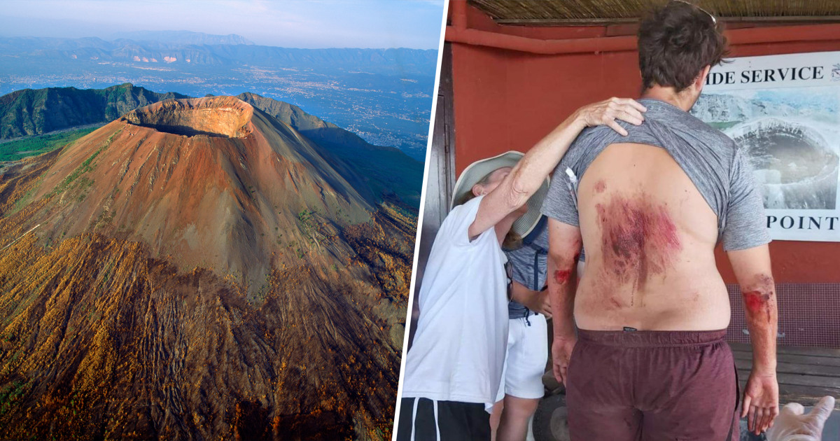 Tourist, 23, Injured After Falling Into Mount Vesuvius Crater While ...