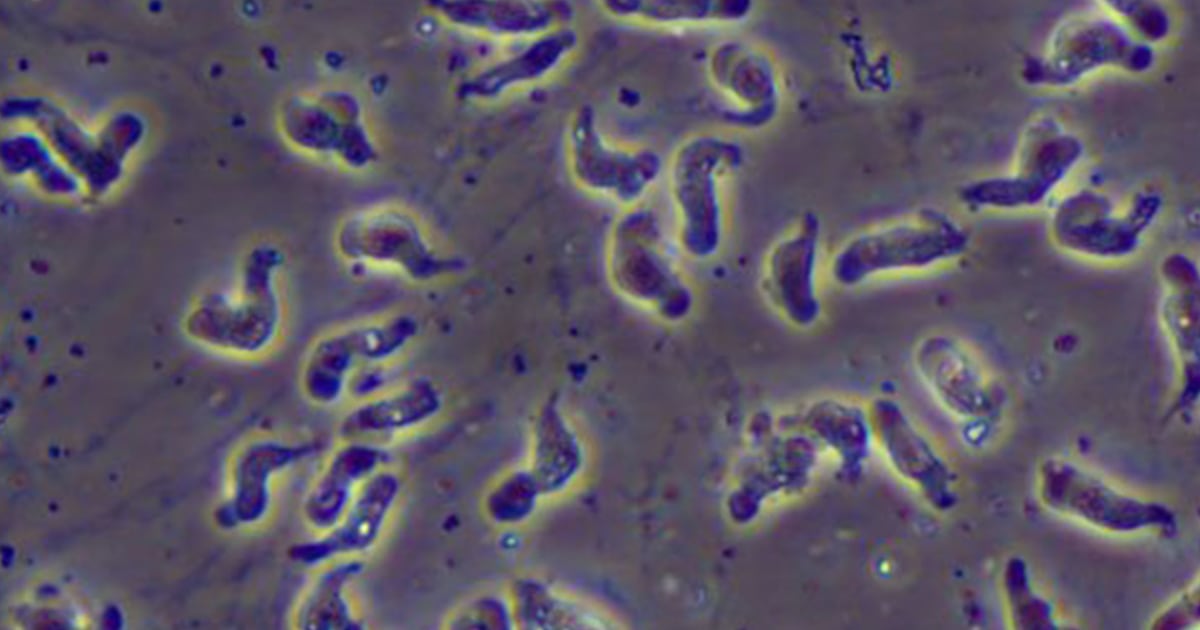 Swimmer Dies After Contracting 'Brain-Eating Amoeba' in Lake in Iowa