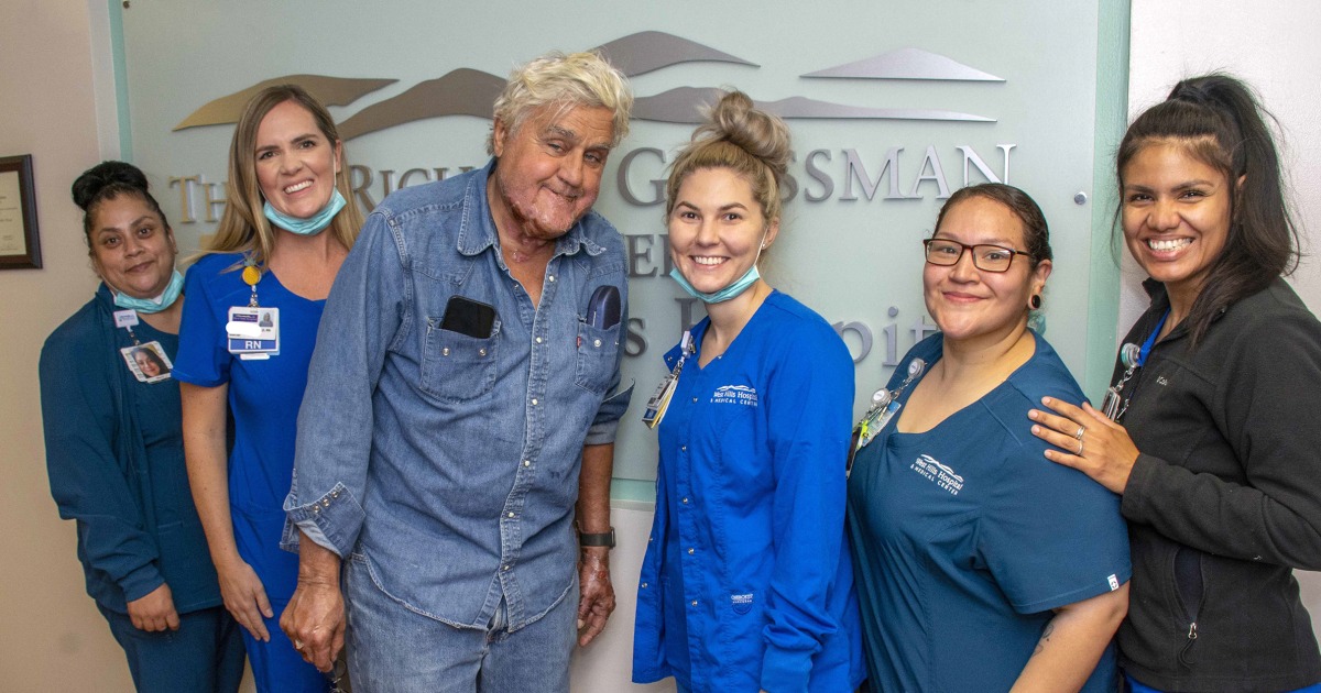 Jay Leno Released from Burn Center After Garage Fire