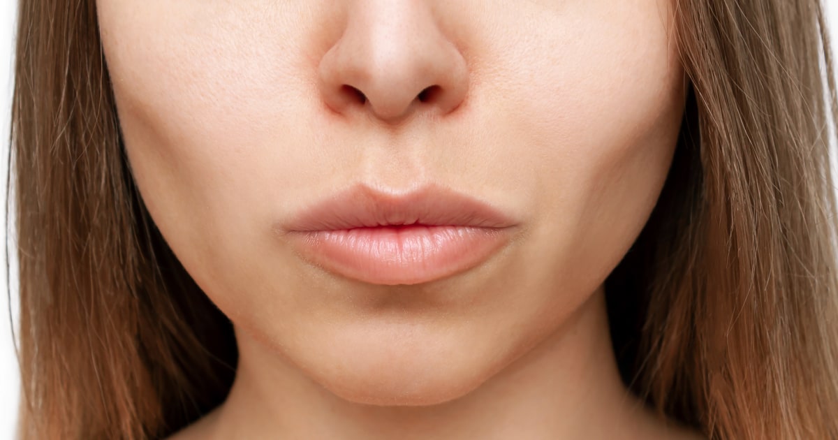 Buccal Fat Removal - What It is & Why Everyone is Talking About It