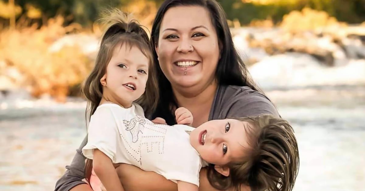 Chelsea Torres Shares What Life Is Like For Her Conjoined Twins