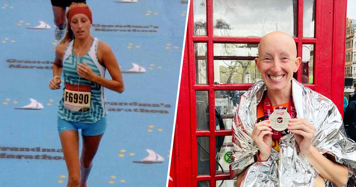 I'm a Runner with Alopecia. Giving Up My Wig Felt Like Freedom