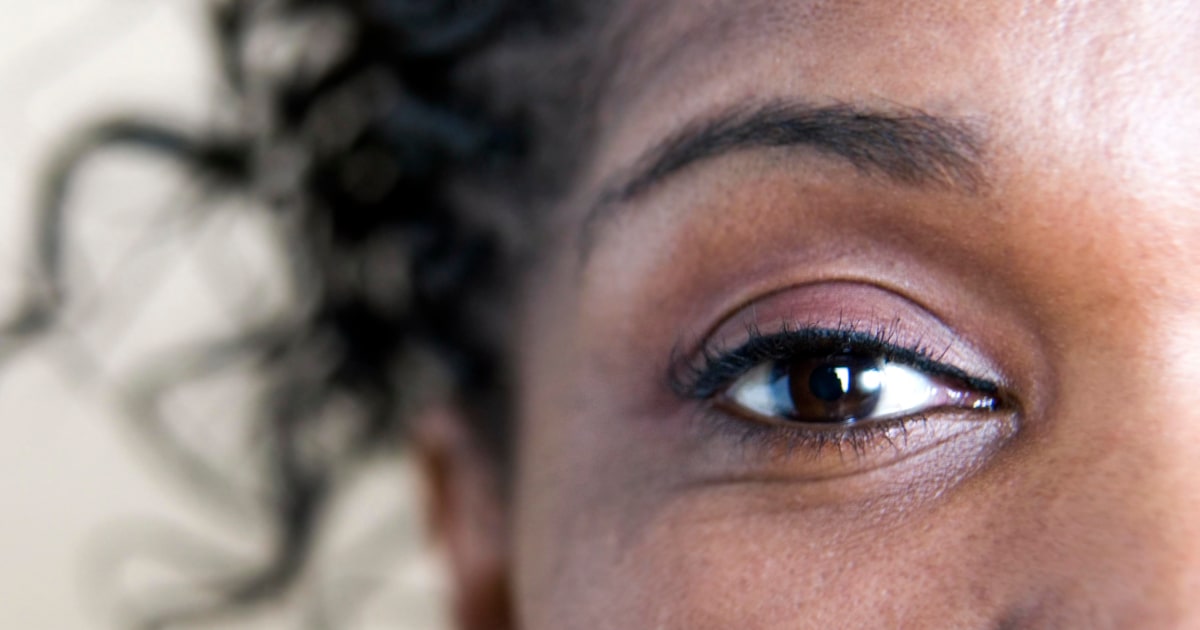 Tear Trough Filler: What To Know About The Under-Eye Procedure