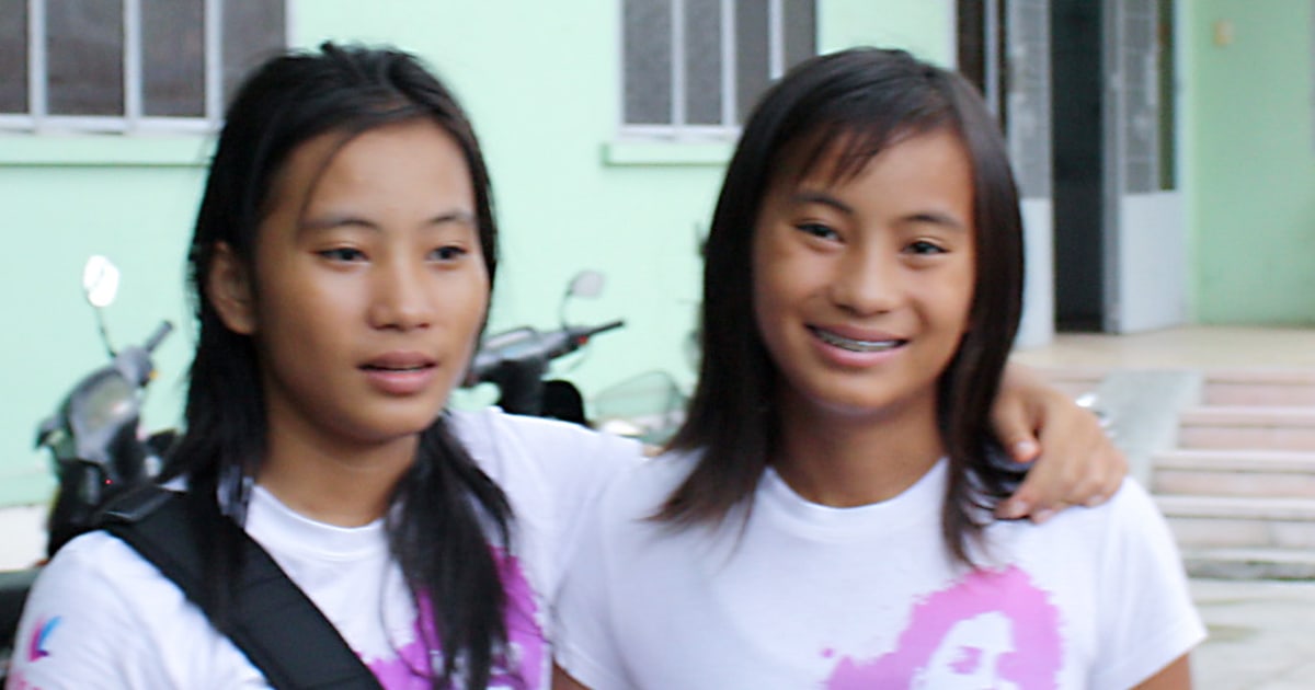 Identical Twins Introduced At 13 Are Now Best Friends