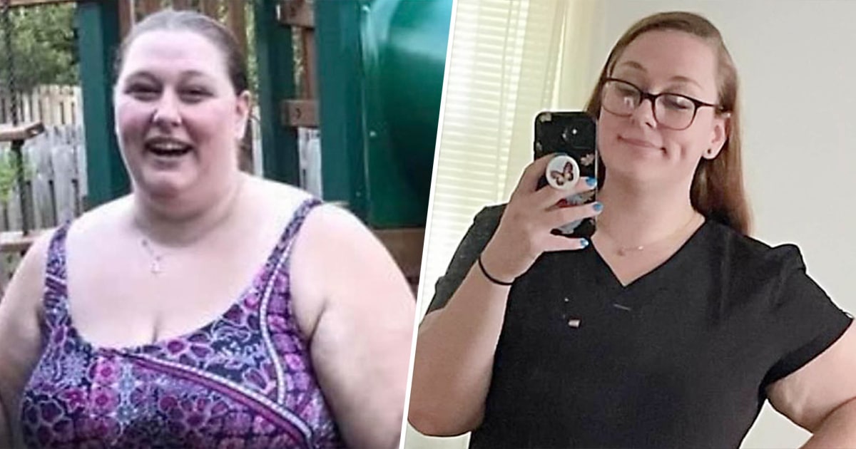 Binge Eater Loses 180 pounds with Walking and High-Protein Diet
