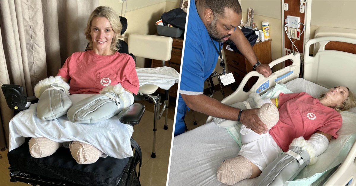 Kidney Stone Leads To Sepsis, Woman Having Legs, Arms Amputated