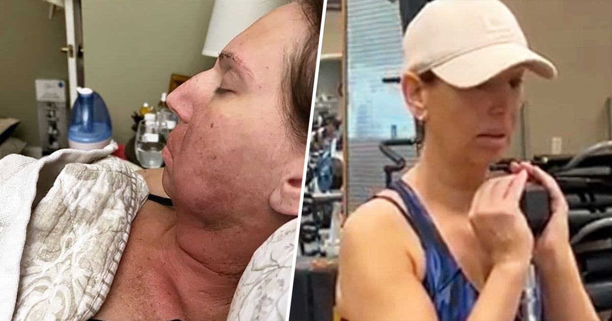 After Mouth Cancer, Fitness Helps Woman Find Strength After Chemo