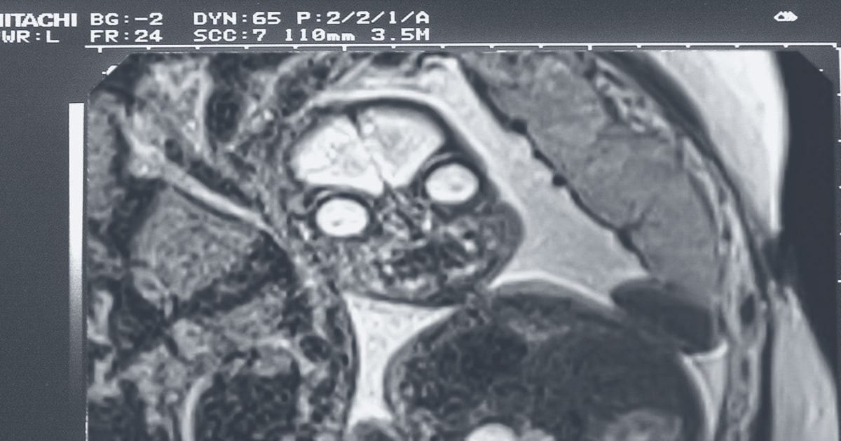 Why Fetal MRIs Images Look Spooky